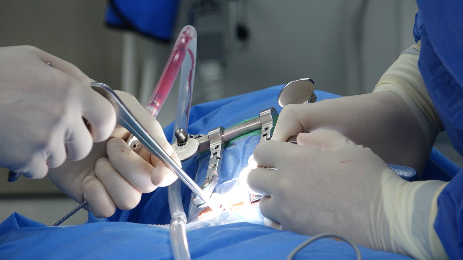 Microendoscopic Discectomy Surgery in Indore - Dr. Suryaprakash ...